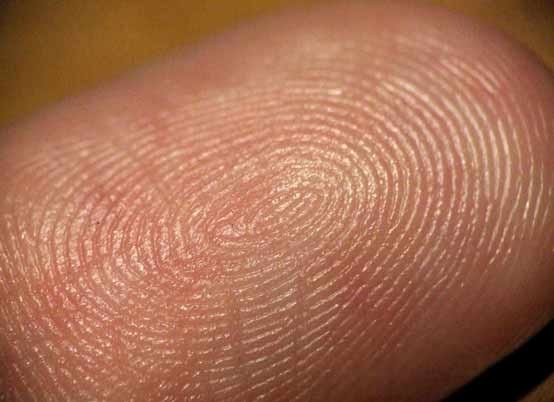 ¿La forma de las manos puede indicar la enfermedad que padeces?