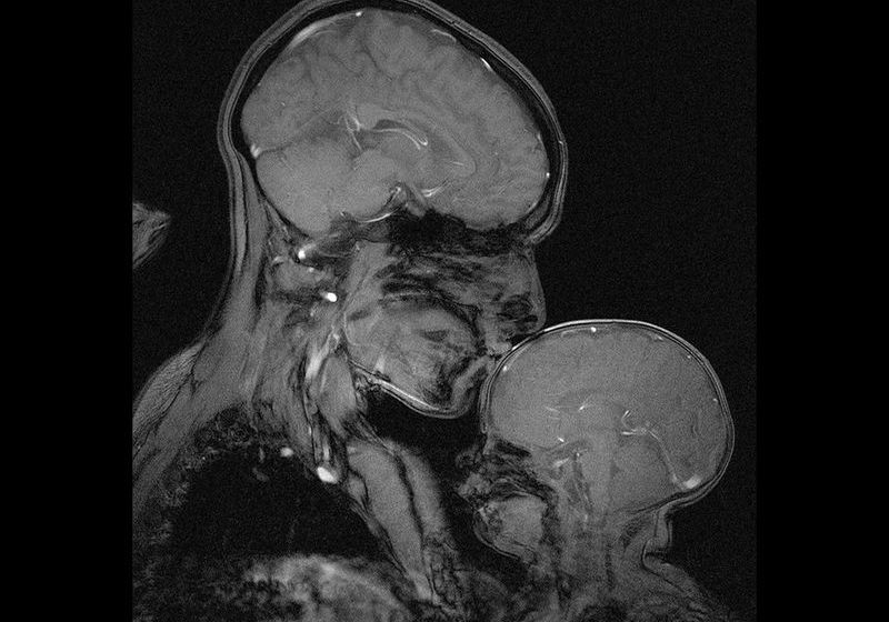 La historia tras la resonancia magnética que mostró a una madre ...