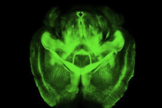 El cerebro transparente: descubriendo los inquietantes secretos de ...