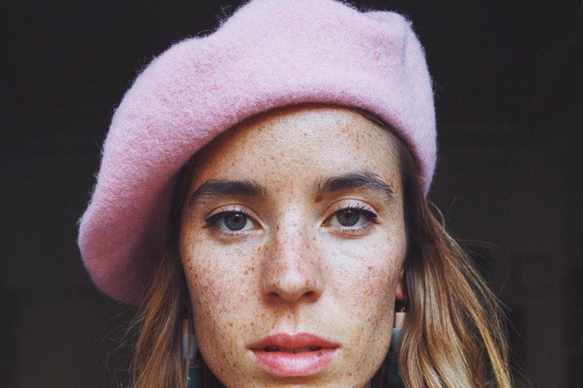 Estas chicas nos enseñan la belleza que hay en un rostro repleto de pecas