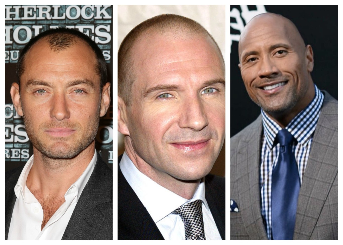 Famosos y famosas que han tenido que lidiar con la alopecia