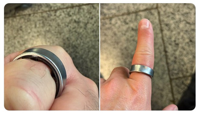 "No volveré a usar un anillo inteligente": tras hincharse la batería ...