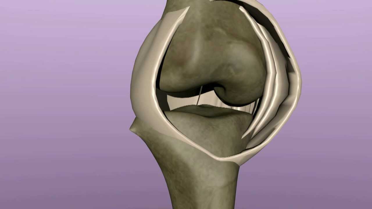 Plica rotuliana: Exploración física y vista 3D