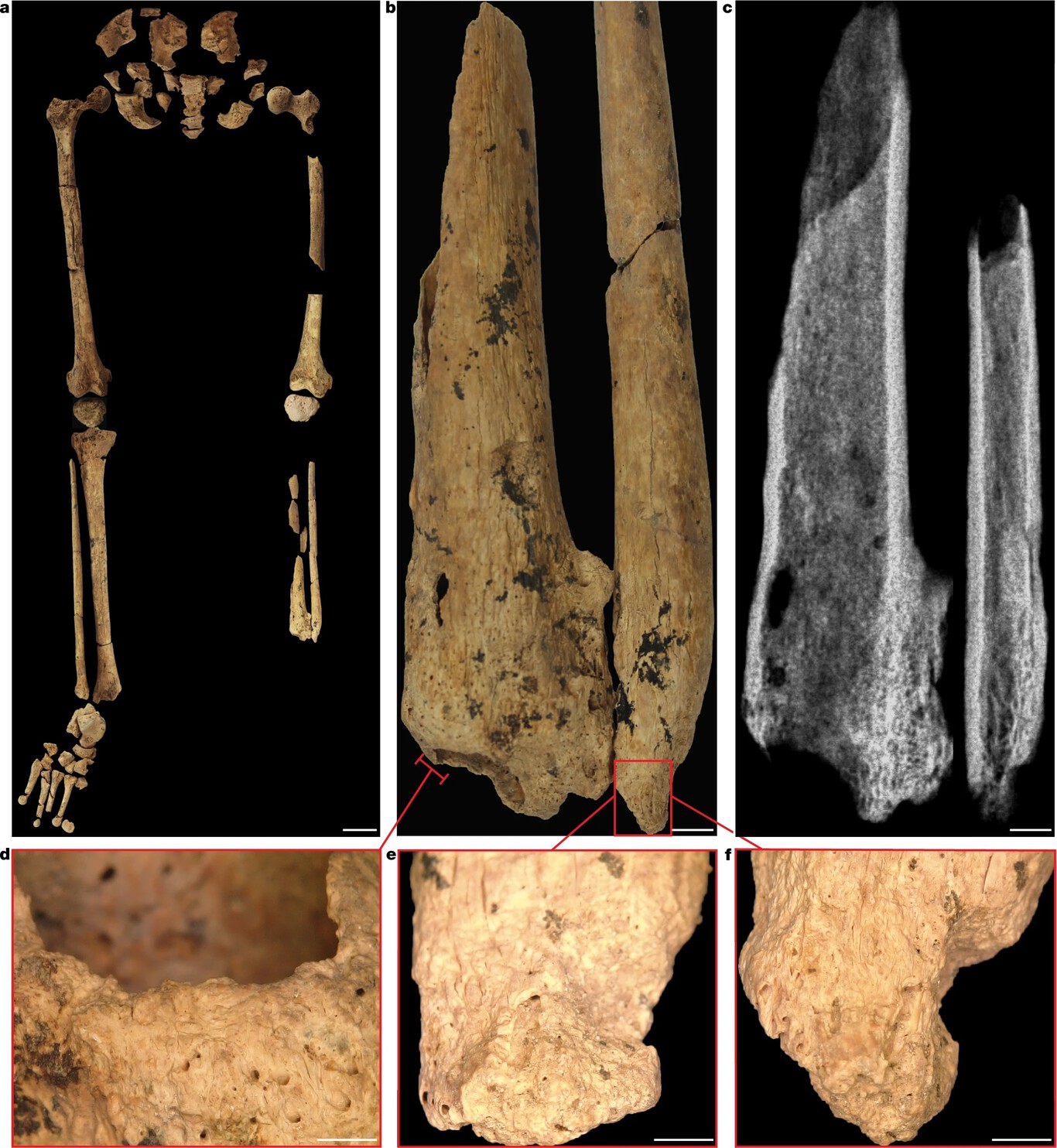 Hemos encontrado un esqueleto de 31.000 años con una pierna amputada ...
