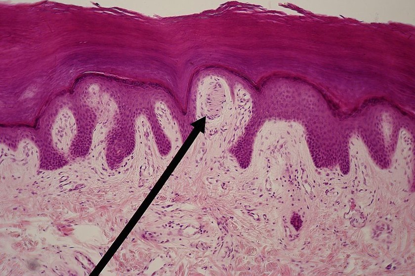 Corpúsculo De Paciniano