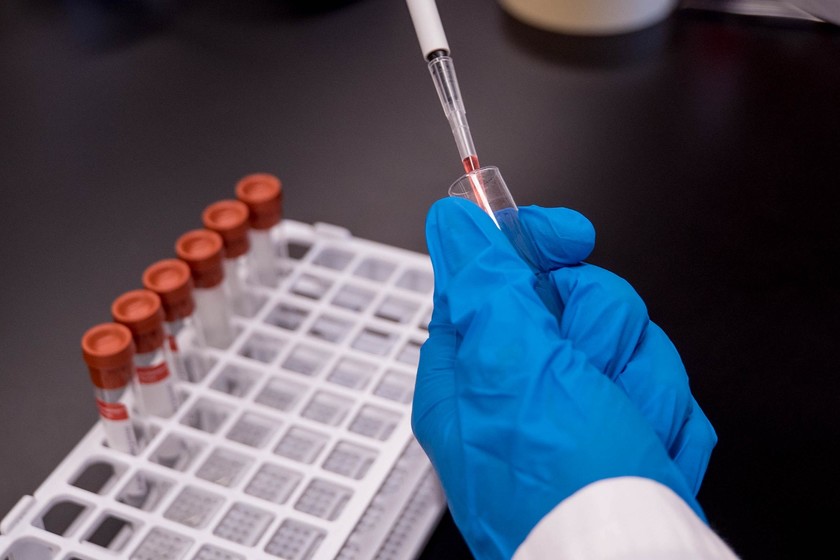 Estos tests nos van a permitir ver la pandemia en cuatro dimensiones ...