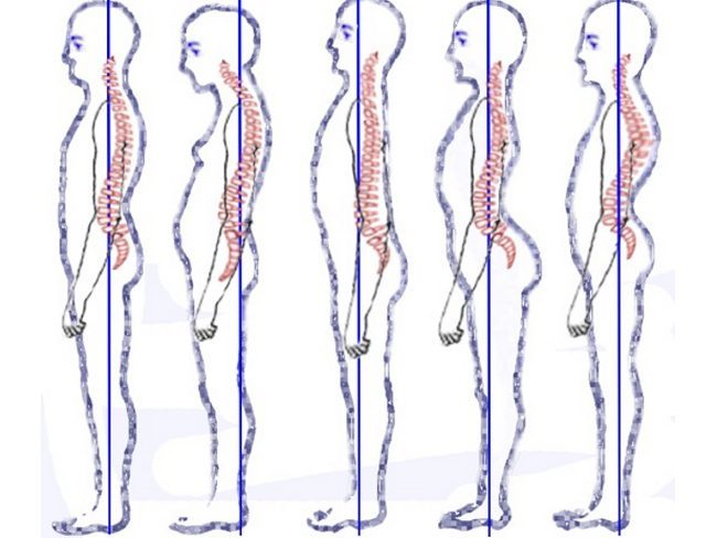 Para una buena postura: trabaja equilibradamente espalda y abdomen