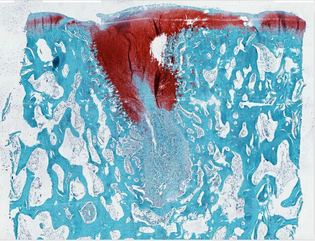 New Biomaterial Achieves What Was Science Fiction Until Now: High ...