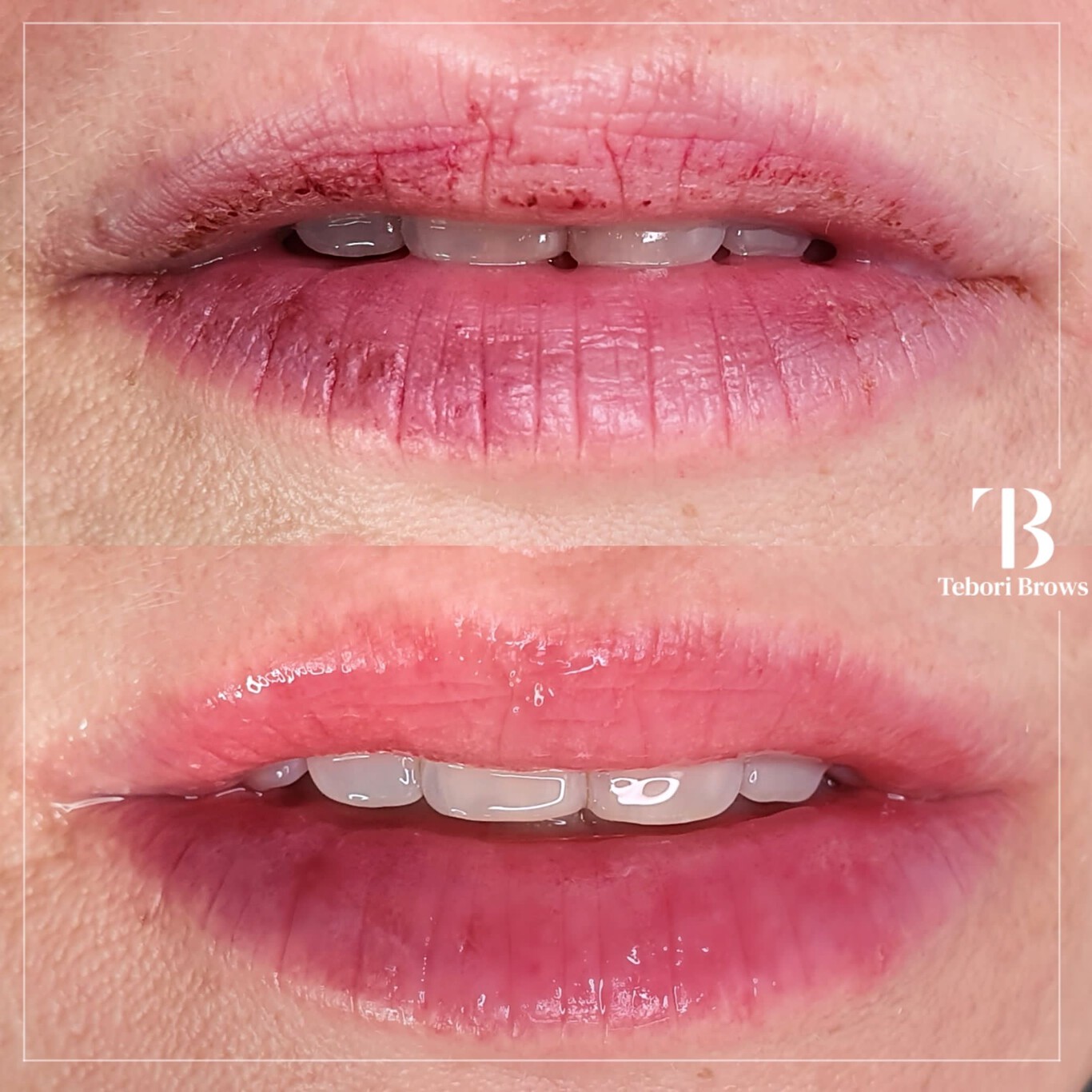 Este tratamiento de hidratación de labios los deja super jugosos y con ...