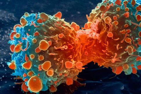 Se creado una prueba universal de cáncer que detecta células mutantes ...