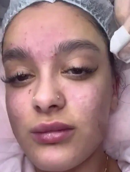 Juls Janeiro no se corta y publica su primera foto sin filtros ni ...