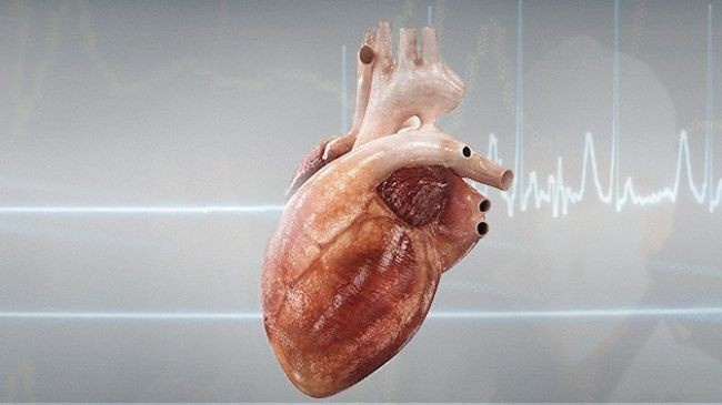 [Vídeo] Imprimiendo en 3D el órgano interno del enfermo