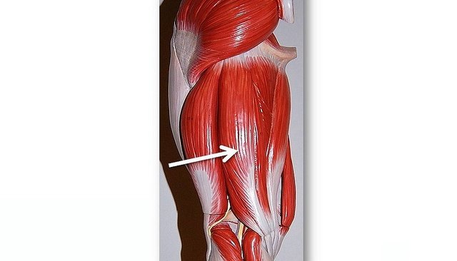 Anatomía:¿Isquiotibiales, femorales? No,Isquiosurales